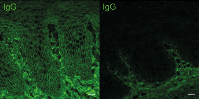 The pemphigus monoclonal antibody clone P5G6 (AX353) retains cell-surface staining by ...